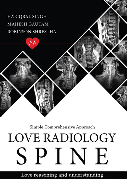 Love Radiology Spine – WFP Store